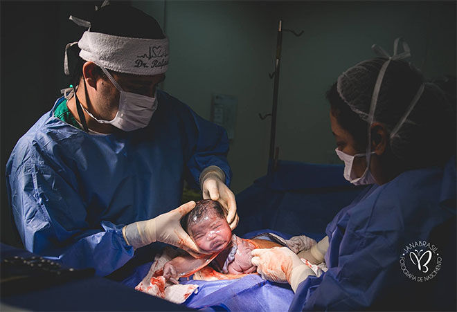 En caul c-section birth caught on camera | Mum's Grapevine